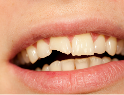 The Scary Effects Candy Has On Children's Teeth | Shoal Creek Smiles